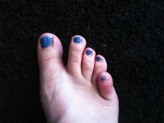 Backpacking Footwear: Toe Shoes - Backpacking Light